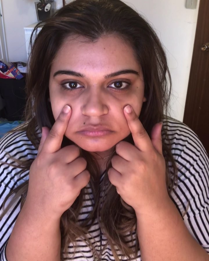 I Have Genetic Dark Circles And Pigmentation Marks I m Working On My i-have-genetic-dark-circles-and-pigmentation-marks-i-m-working-on-my